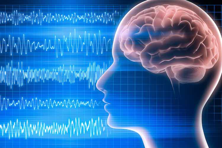 Electroencephalogram EEG MyDr au