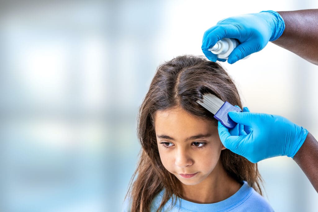 Video: How to treat head lice - myDr.com.au
